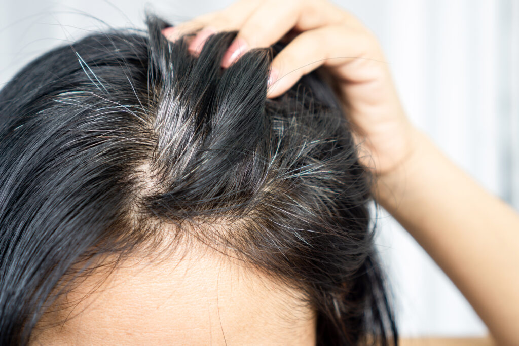 Is Your Hair Turning Grey? Fight It With ThriveCo's Hair Prime Serum ...